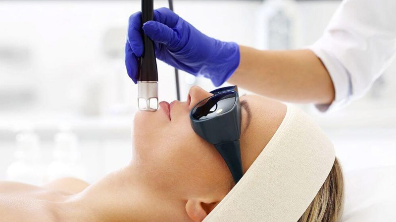 L ser Fraccional No Ablativo SkinCare Medicina Est tica L ser Fraccional No Ablativo SkinCare Medicina Est tica